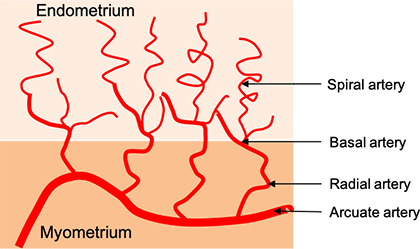 Placenta Accreta Spectrum - FMF Courses