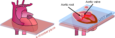 Fetal cardiac scanning - FMF Courses
